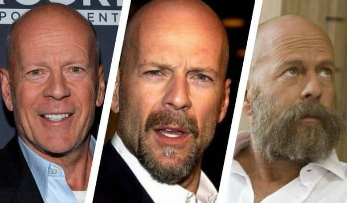 Here’s Why Every Balding Man Needs to Grow a Beard (Now)