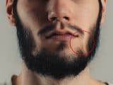 Painful Beard: 7 Must-Know Reasons Why Your Beard Hurts